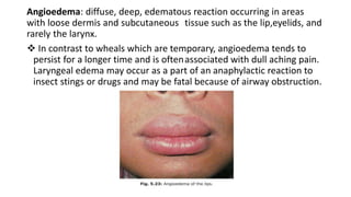 MORPHOLOGY OF SKIN LESIONS powerpoint dvl | PPTX