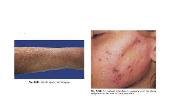 MORPHOLOGY OF SKIN LESIONS powerpoint dvl | PPT