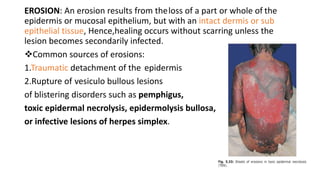 MORPHOLOGY OF SKIN LESIONS powerpoint dvl | PPT