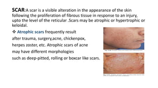 MORPHOLOGY OF SKIN LESIONS powerpoint dvl | PPT