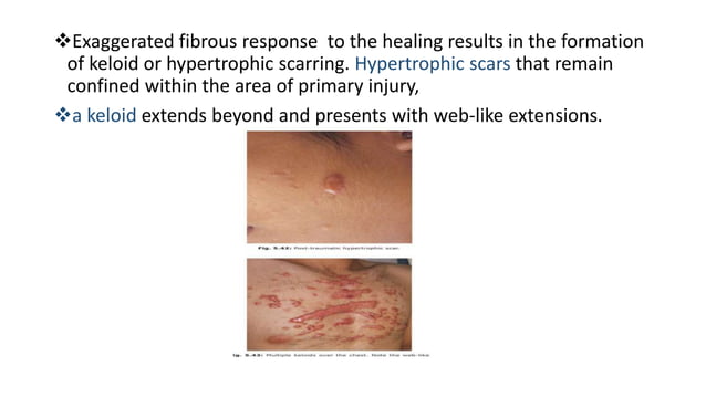 MORPHOLOGY OF SKIN LESIONS powerpoint dvl | PPT
