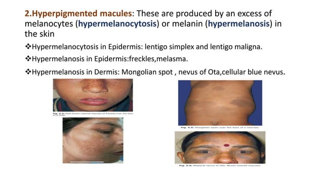 MORPHOLOGY OF SKIN LESIONS powerpoint dvl | PPT