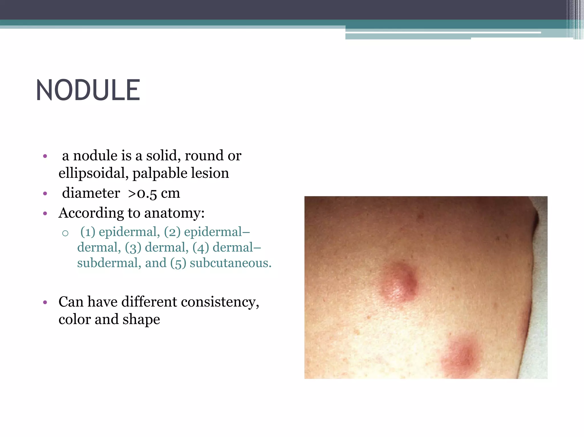 Morphology of skin lesions tim | PDF