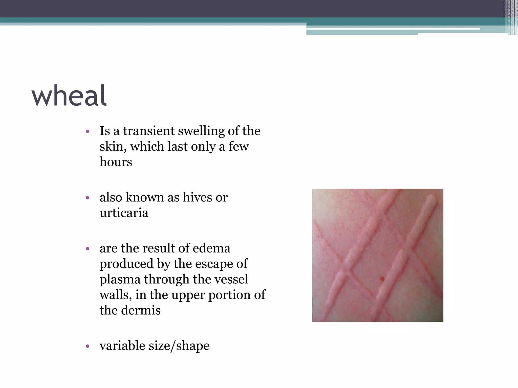 Morphology of skin lesions tim | PDF