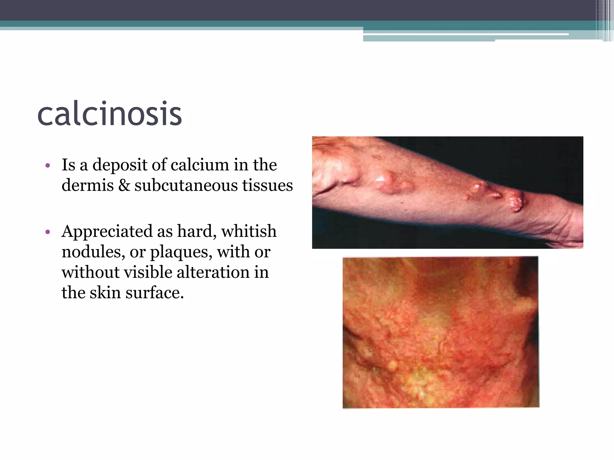 Morphology of skin lesions tim | PDF