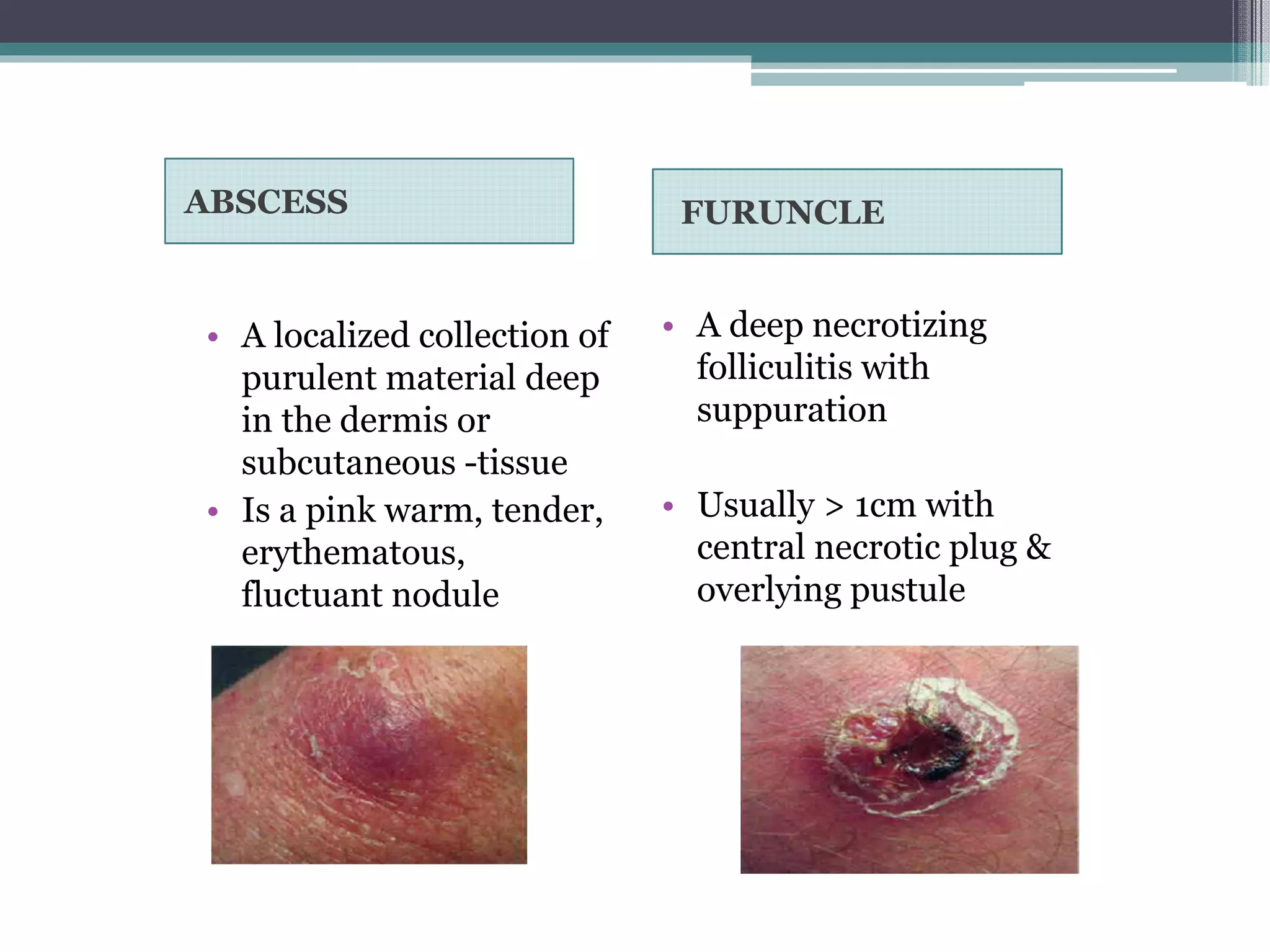 Morphology of skin lesions tim | PDF