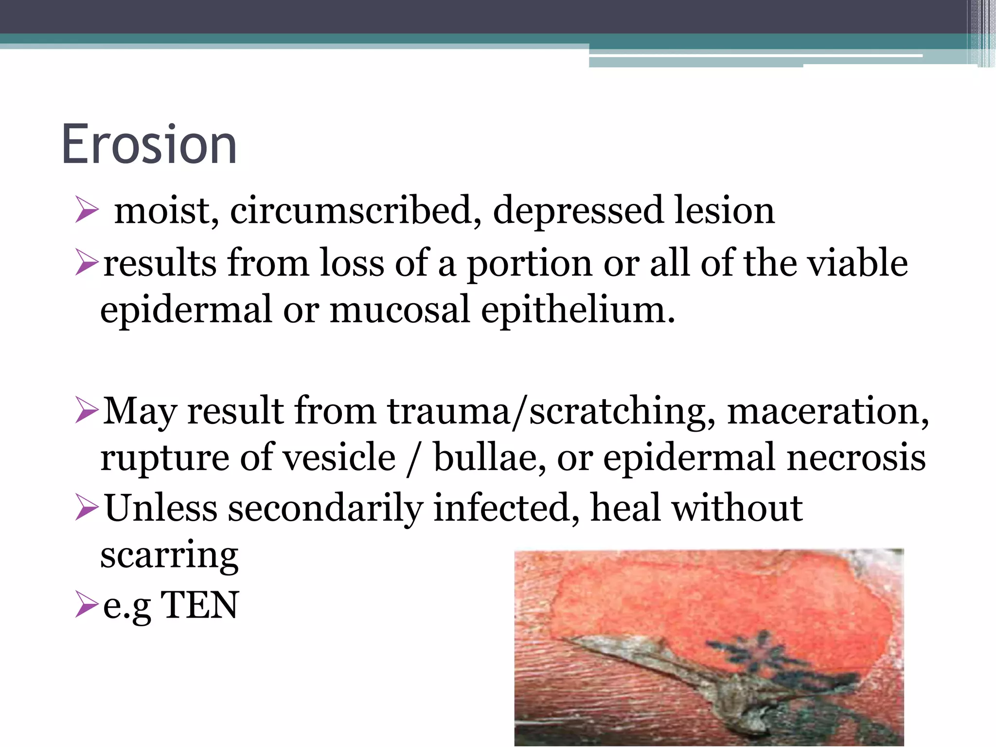 Morphology of skin lesions tim | PDF