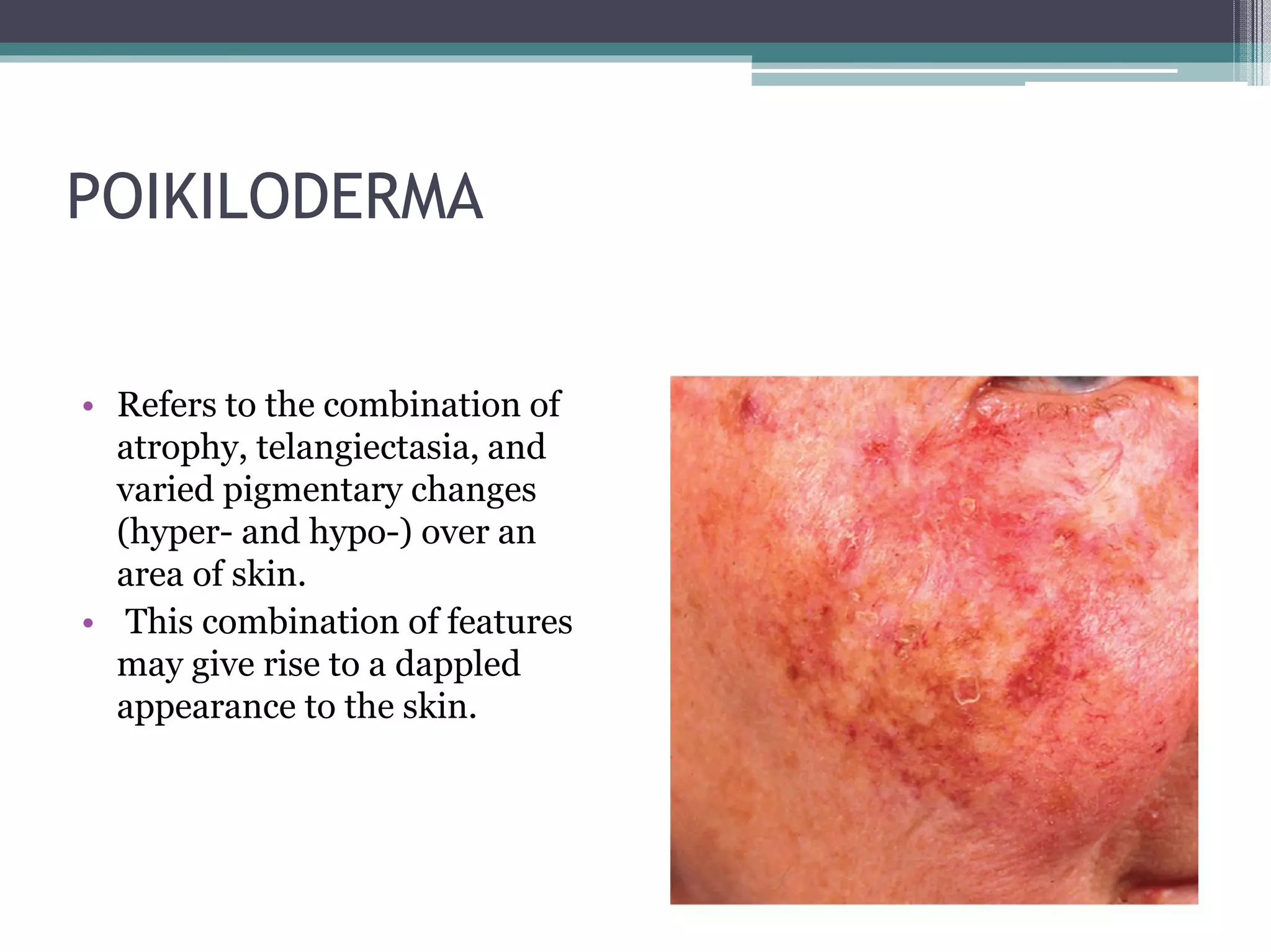 Morphology of skin lesions tim | PDF