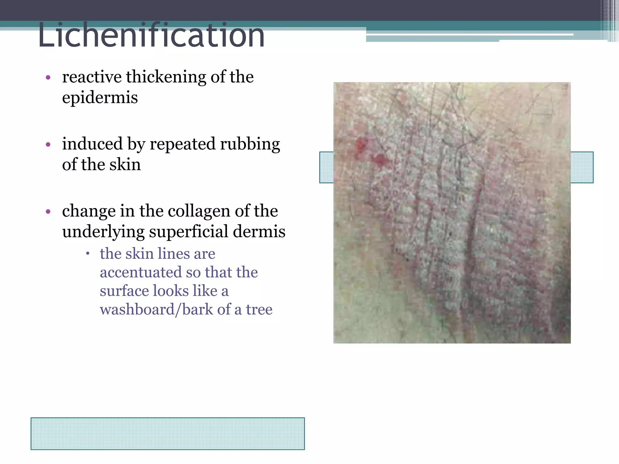 Morphology of skin lesions tim | PDF