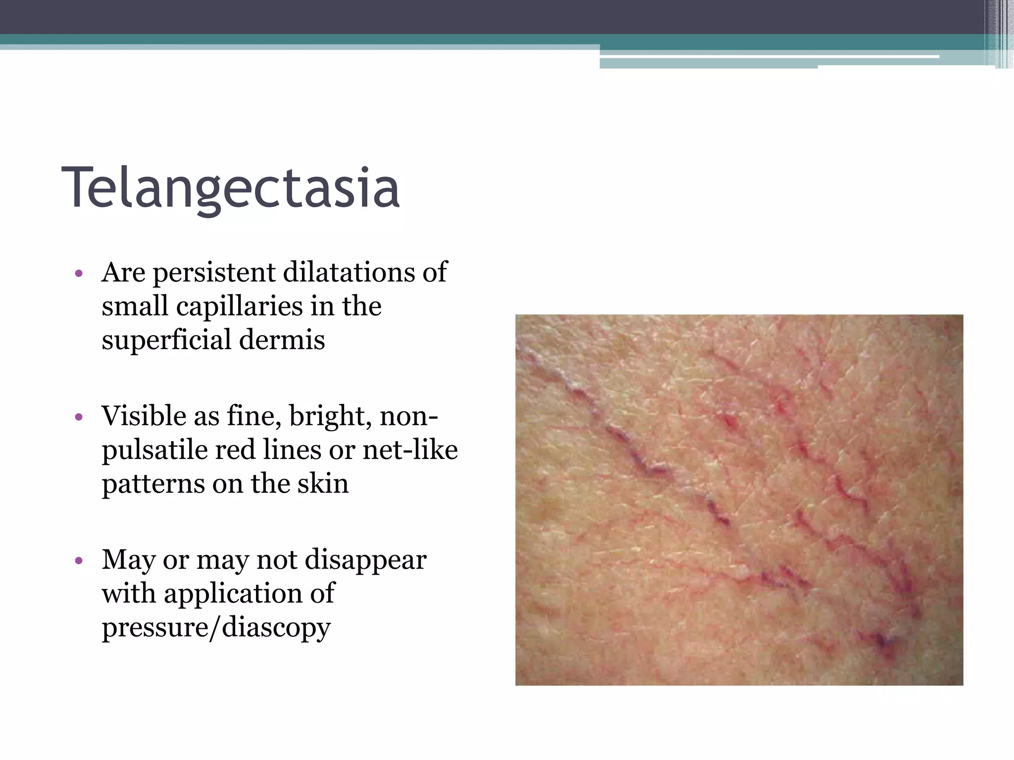 Morphology of skin lesions tim | PDF