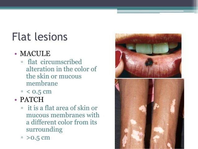 Morphology of skin lesions tim | PDF