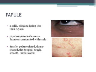 Morphology of skin lesions tim | PDF