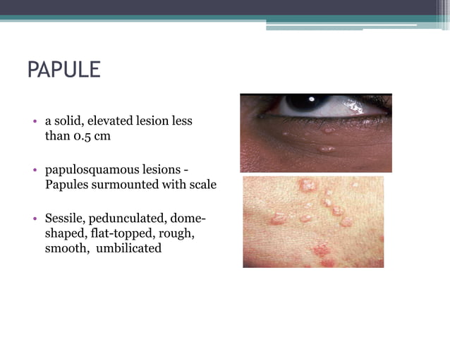 Morphology of skin lesions tim | PDF