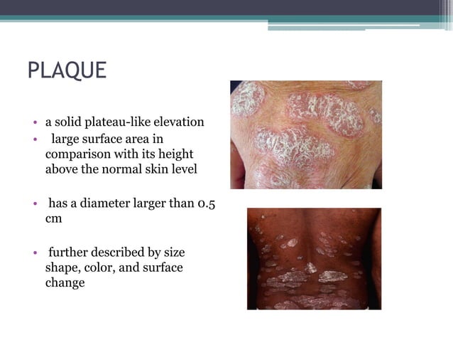 Morphology of skin lesions tim | PDF