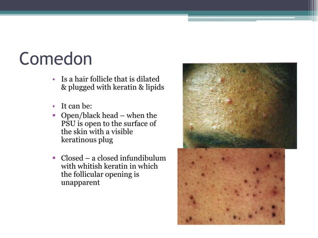 Morphology of skin lesions tim | PDF