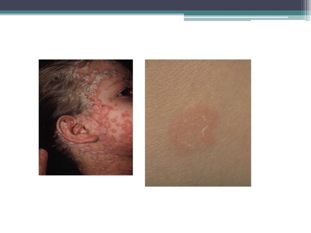 Morphology of skin lesions tim | PDF