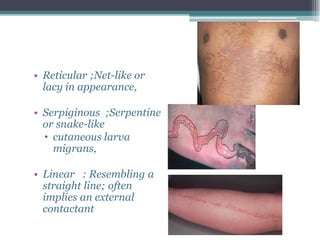 Morphology of skin lesions tim | PDF