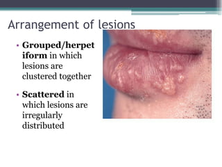 Morphology of skin lesions tim | PDF