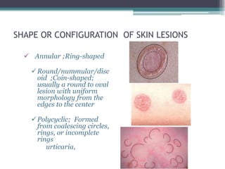 Morphology of skin lesions tim | PPT
