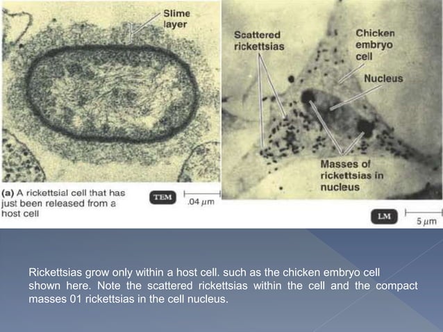 morphology & structure of spirochete, fungi & protozoa | PPT ...