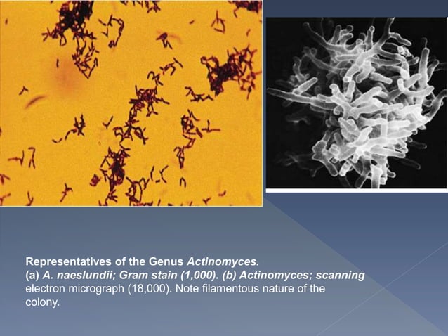 morphology & structure of spirochete, fungi & protozoa | PPT ...