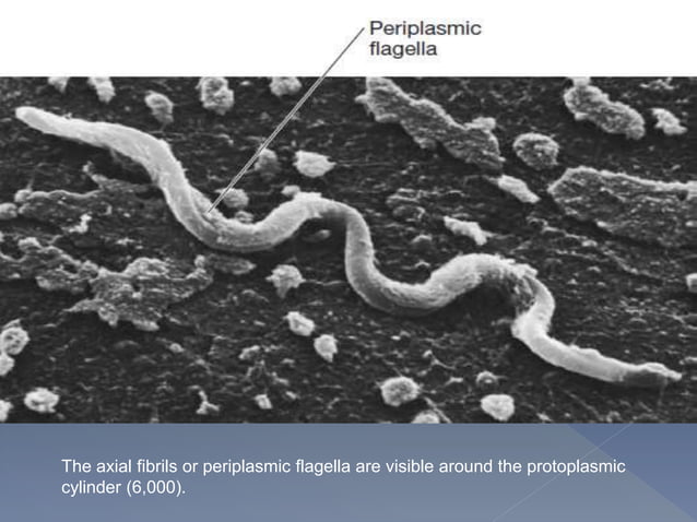 morphology & structure of spirochete, fungi & protozoa | PPT ...