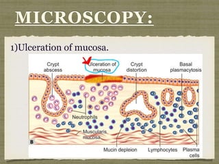 Morphology of ulcerative colitis | PPT