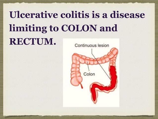 Morphology of ulcerative colitis | PPT