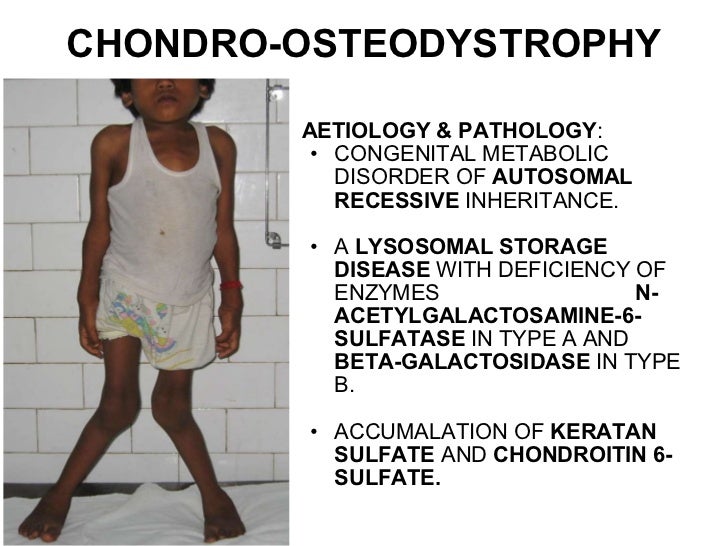 Morquio Syndrome