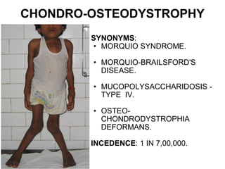 Morquio syndrome | PPT