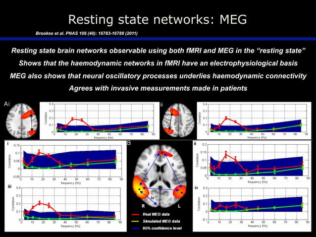 Multimodal functional MRI (多模态功能磁共振成像) | PDF