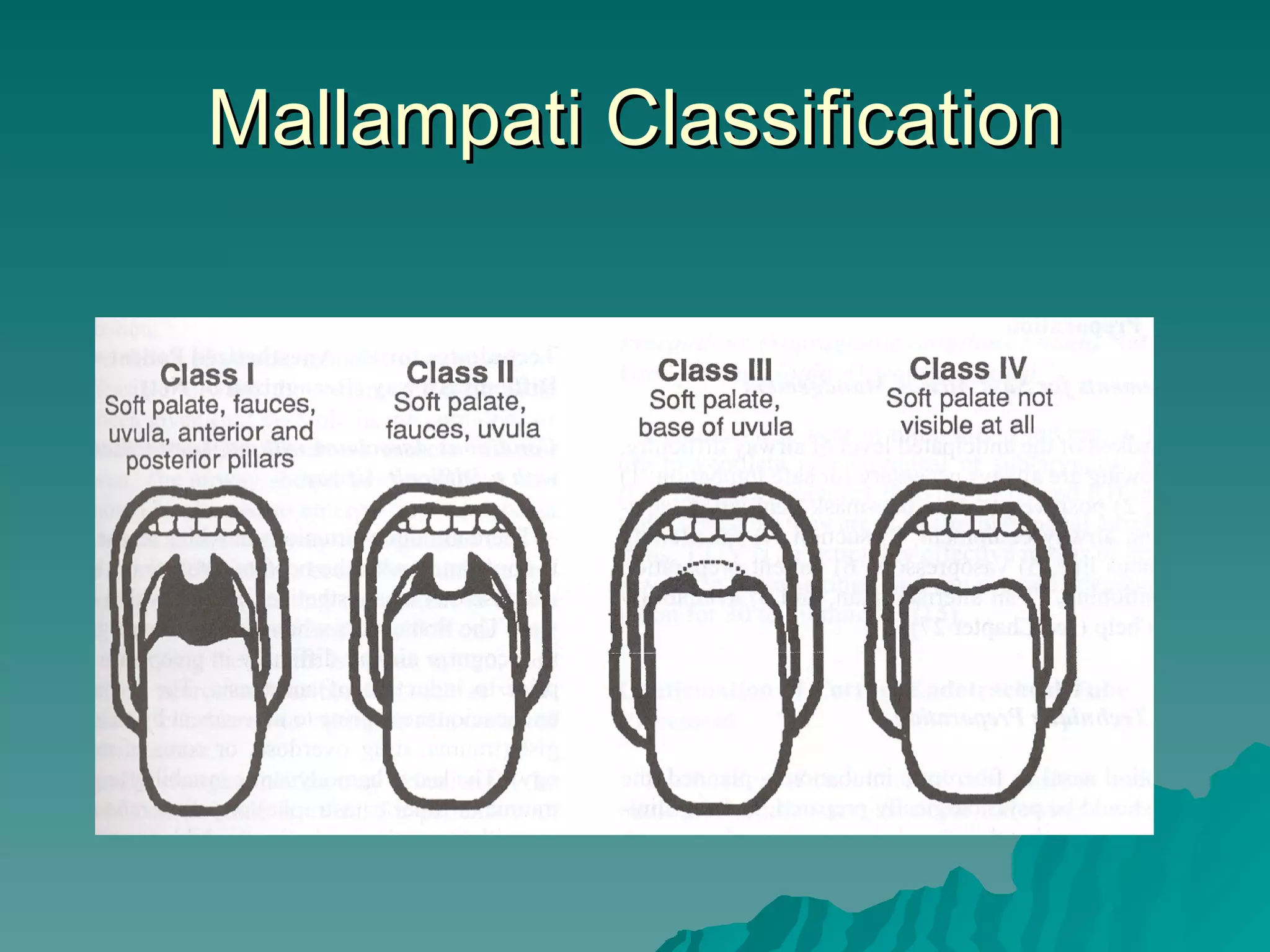 Morrissey Airway Positioning | PPT