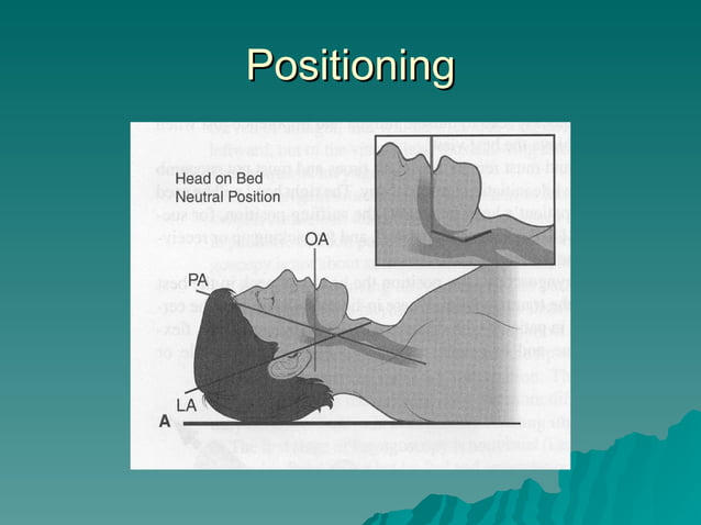Morrissey Airway Positioning | PPT