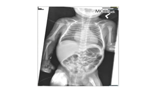 Mortality review.ppt