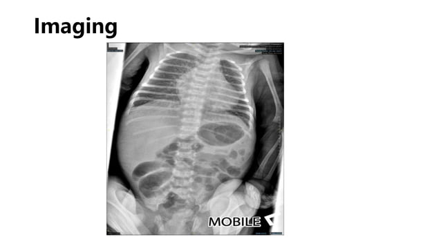 Mortality review.ppt