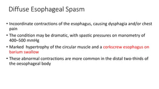 Diffuse Esophageal Spasm