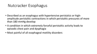 Diffuse Esophageal Spasm Vs Nutcracker Esophagus