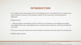Morton Neuroma | PPTX