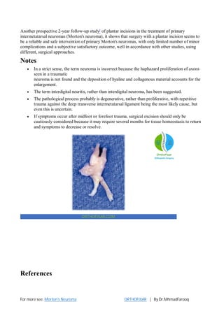 Mortons neuroma | PDF | Death, Injury, or Military Conflict | Sensitive ...