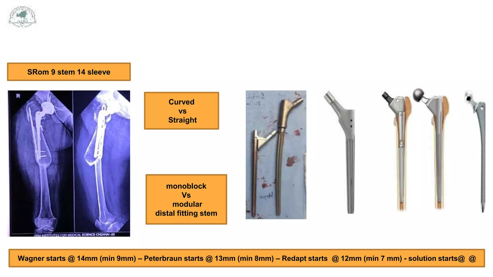 Complex Total Hip Replacement - Asian Joint Reconstruction Institute ... Complex Total Hip Replacement - Asian Joint Reconstruction Institute ...