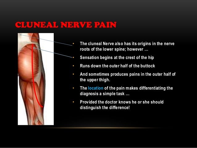 Most common back pain mis diagnosis!