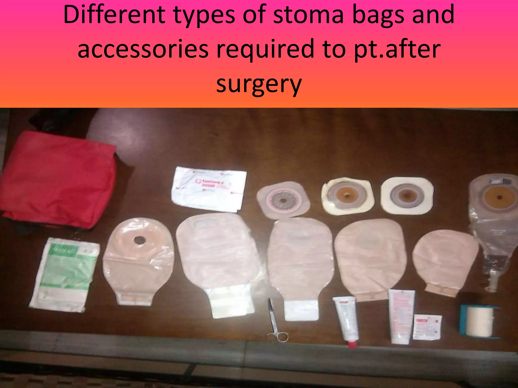 Most common ileostomy complications | PPTX