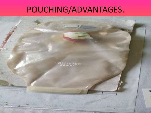 Most common ileostomy complications | PPTX | Digestive Disorders ...