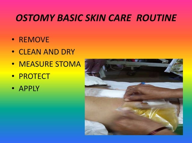 Most common ileostomy complications | PPTX | Digestive Disorders ...