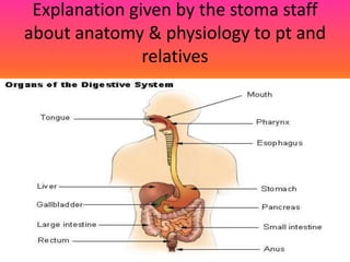 Most common ileostomy complications | PPTX