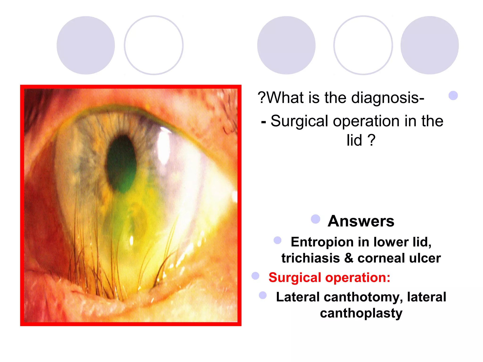 Most common opthalmology slides with anwers in uhs ospe | PPT