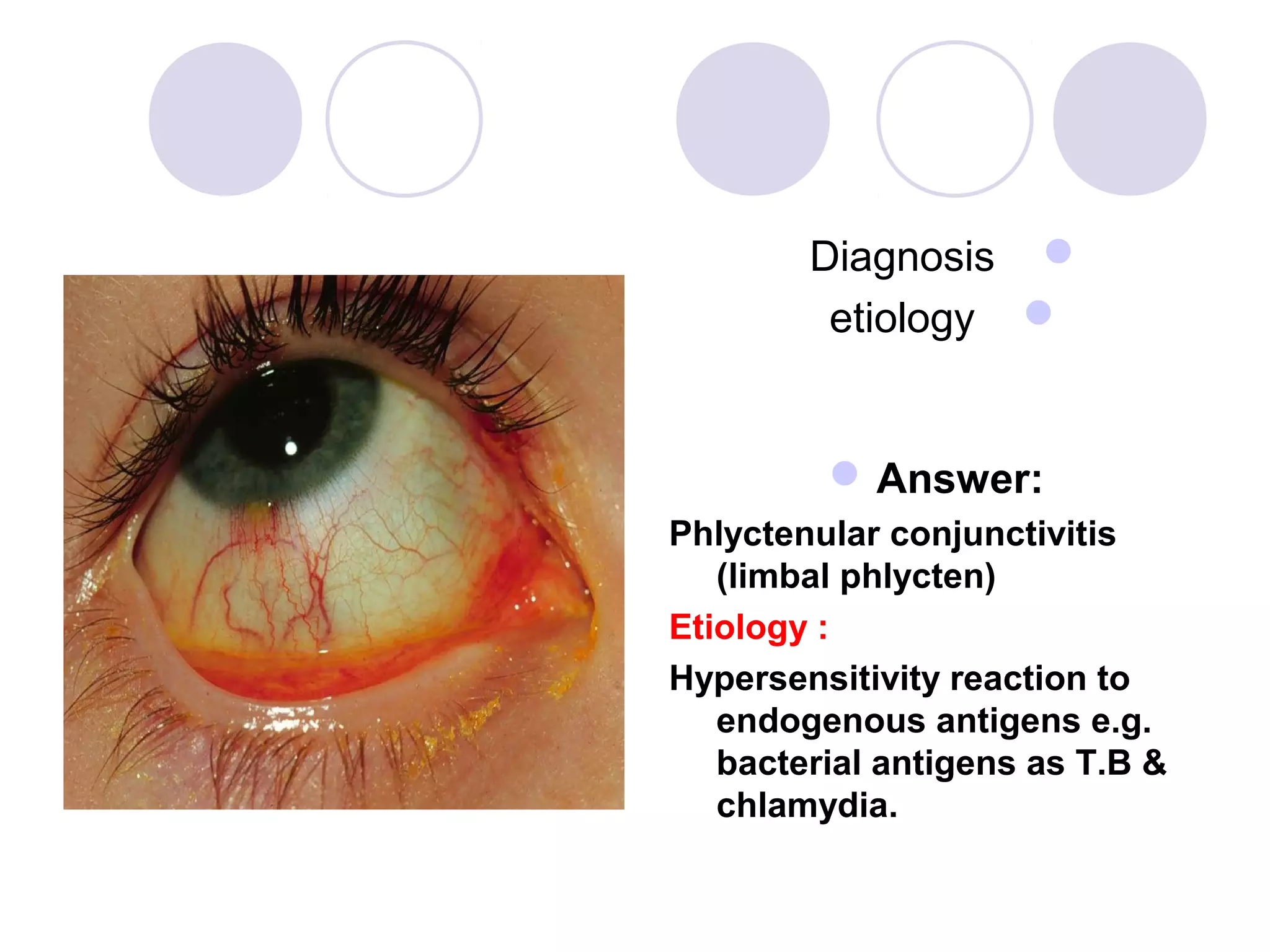 Most common opthalmology slides with anwers in uhs ospe | PPT