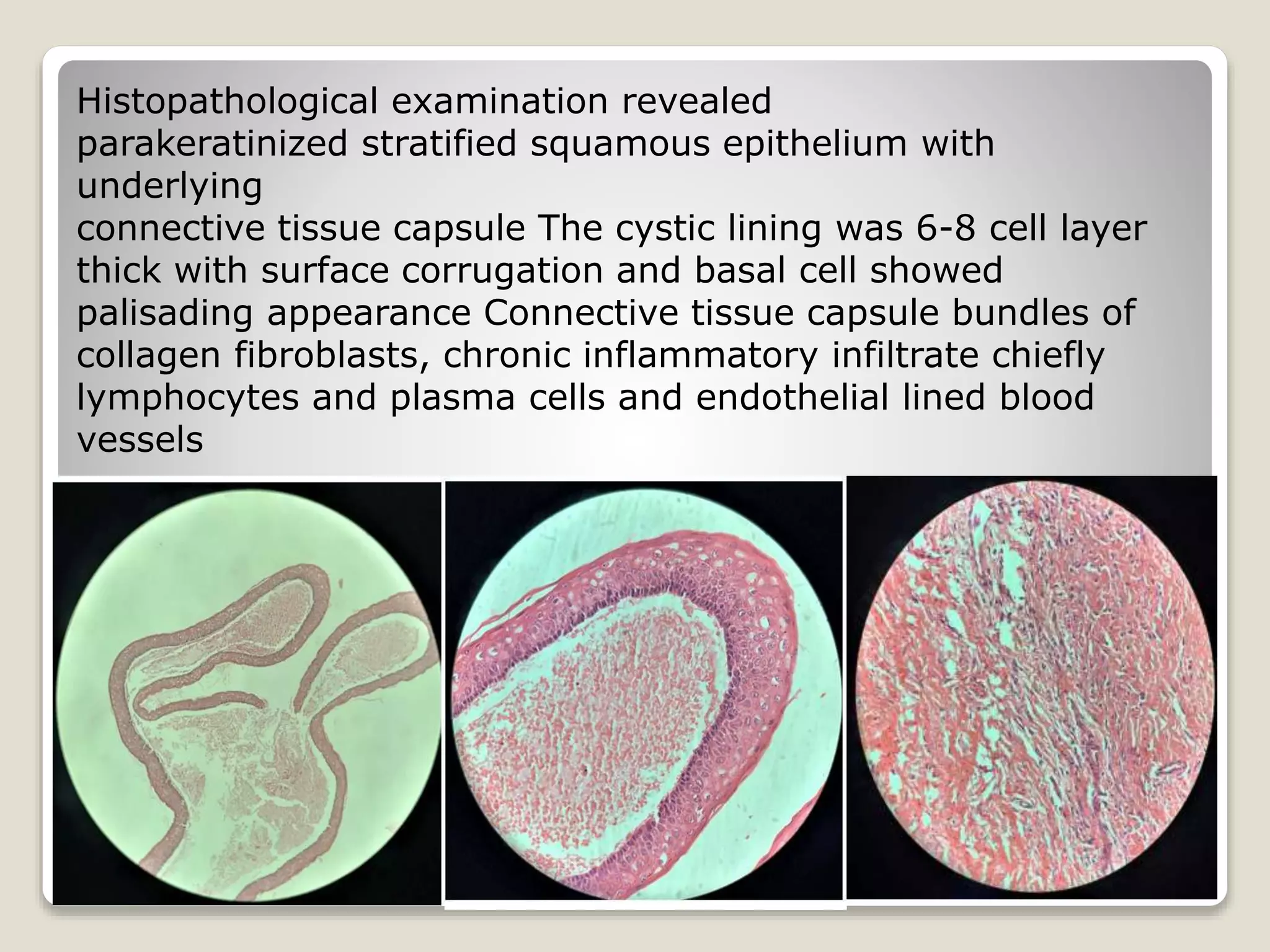 Cyst/pathologies in mandible DDX | PPTX | Dental Health | Diseases and ...