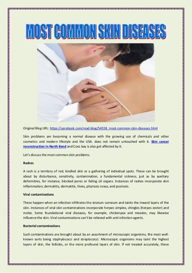 Most common skin diseases