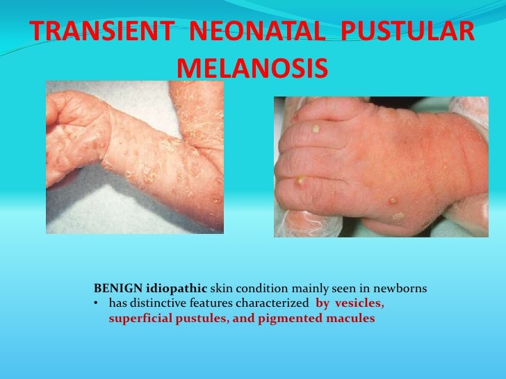 NEW BORN CARE AND INFECTIONS